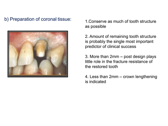Post and core | PPTX | Dental Health | Diseases and Conditions