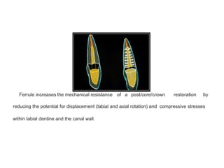 Post and core | PPTX