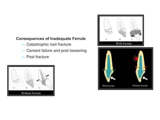 Post and core | PPTX