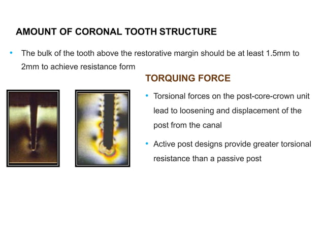 Post and core | PPTX | Dental Health | Diseases and Conditions