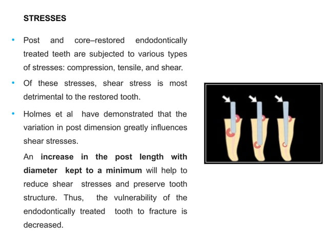 Post and core | PPTX | Dental Health | Diseases and Conditions