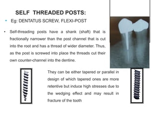 Post and core | PPTX