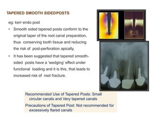Post and core | PPTX