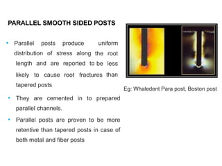 Post and core | PPTX