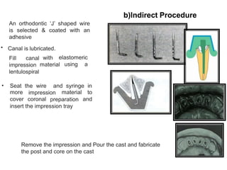 Post and core | PPTX