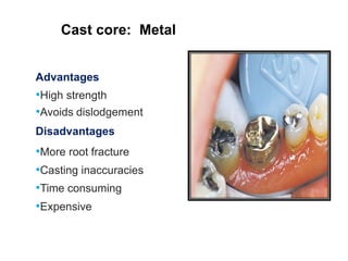 Post and core | PPTX