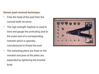 Post and core | PPTX