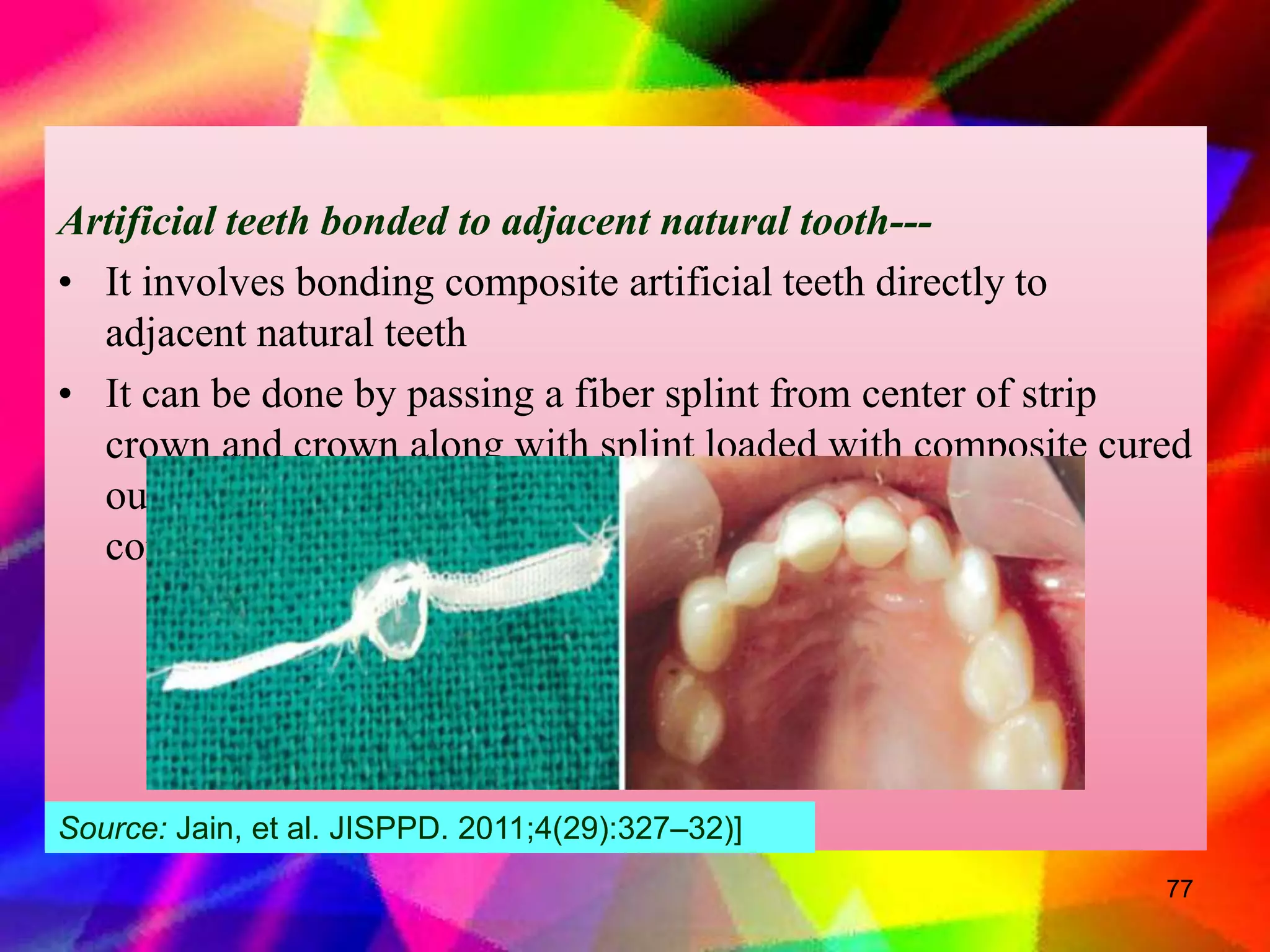 Post and core in primary teeth final to present | PPTX