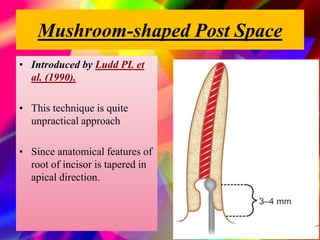 Post and core in primary teeth final to present | PPTX