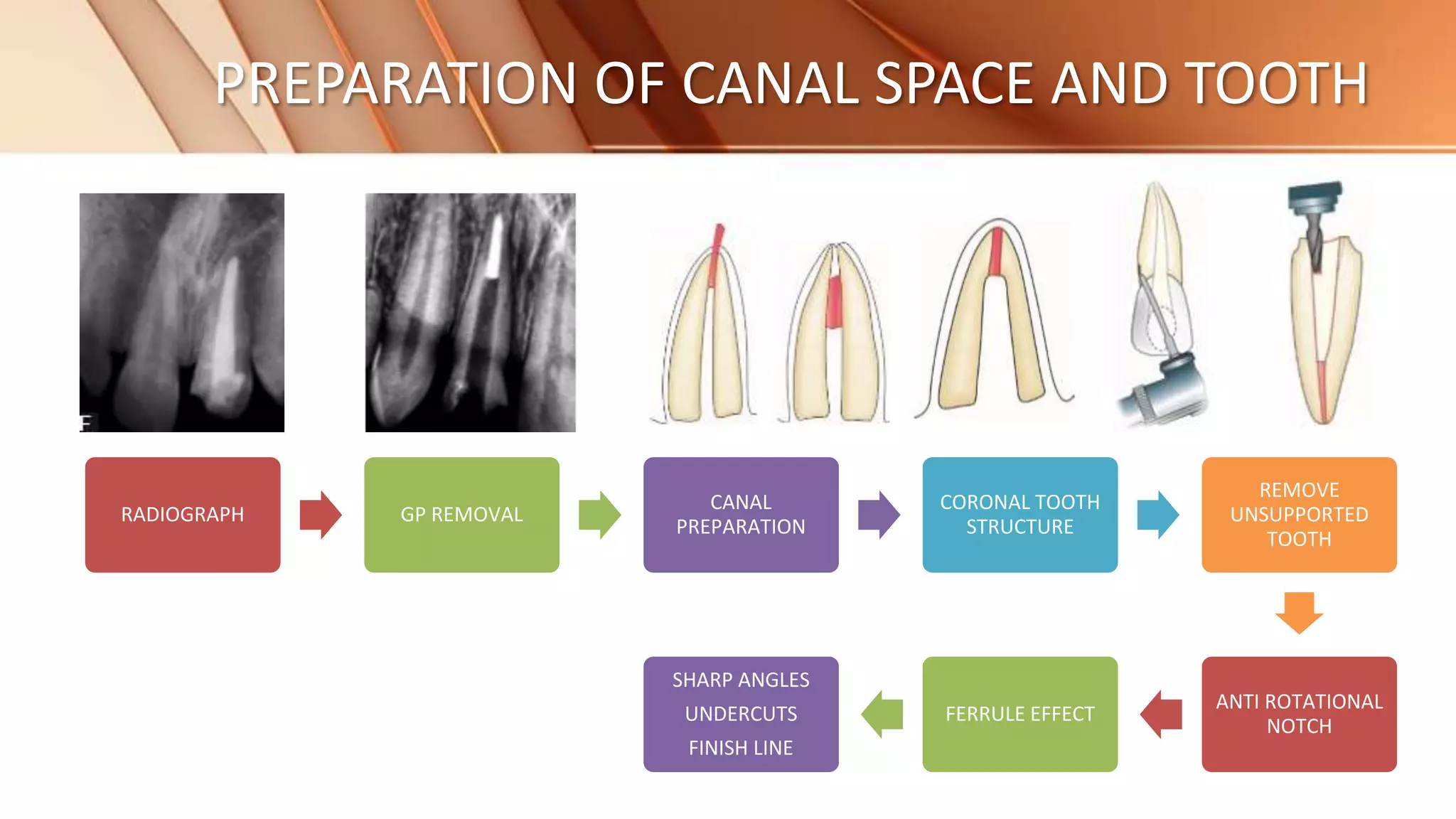 Post and core ppt | PPTX