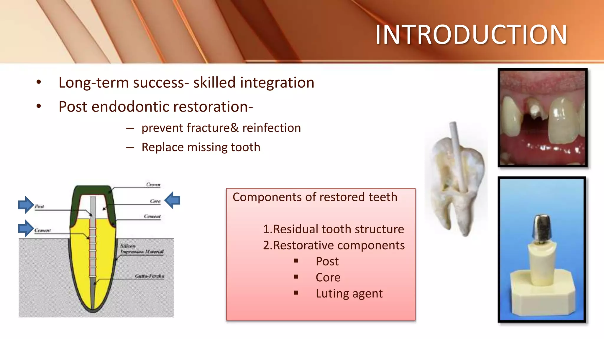 Post and core ppt | PPTX