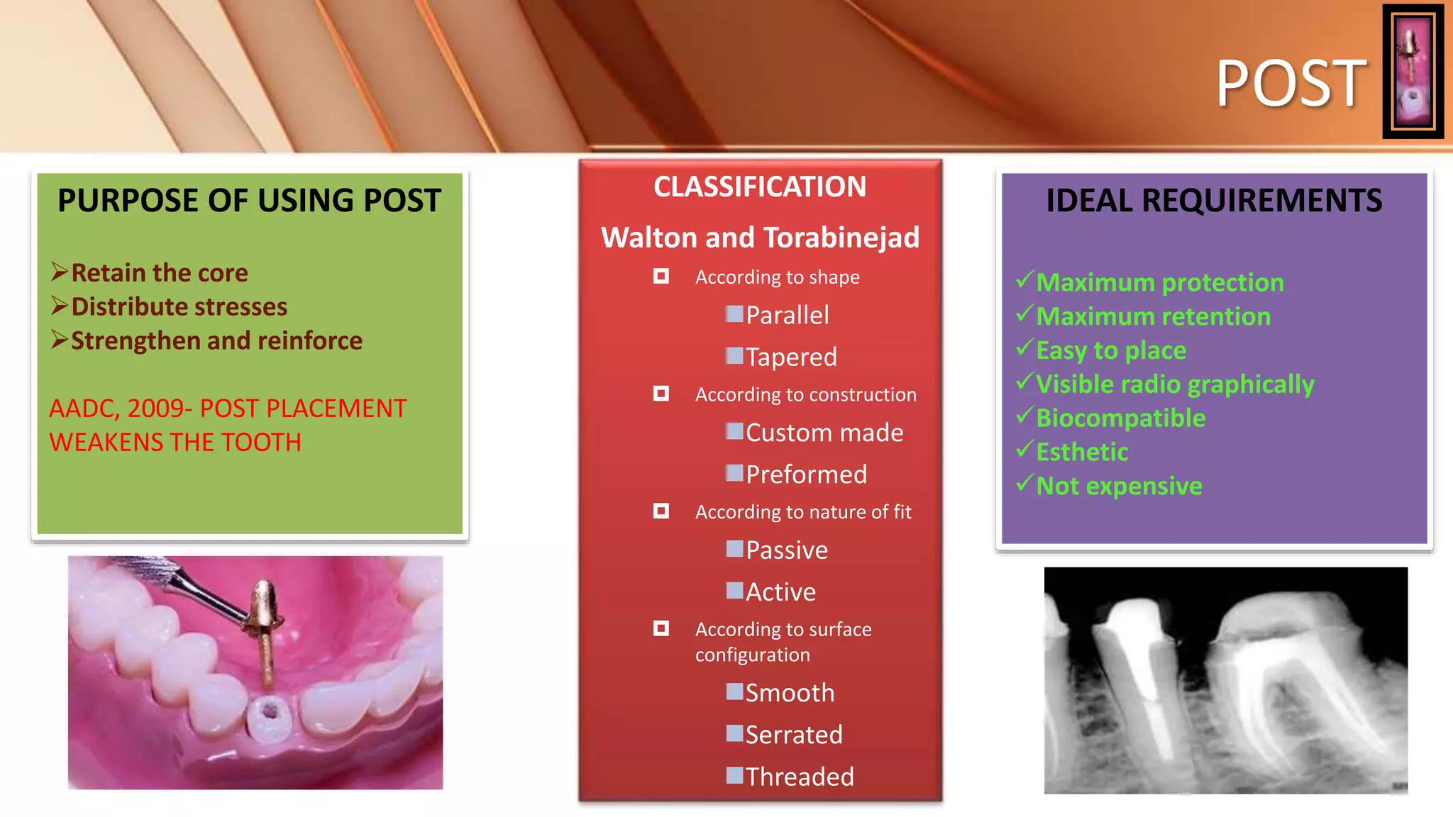 Post and core ppt | PPTX