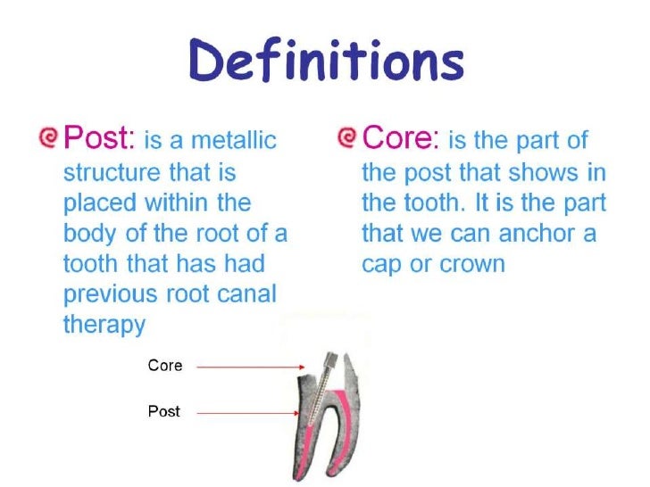 Post and core project
