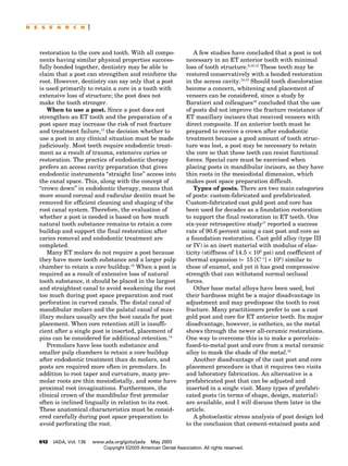 post and cores for endo treated teeth.pdf