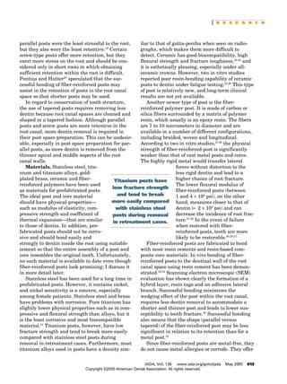 post and cores for endo treated teeth.pdf