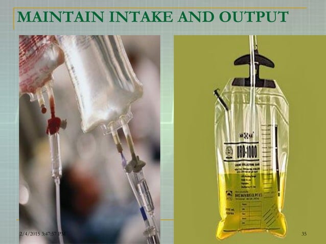 Post anesthesia care unit(PACU) | PDF