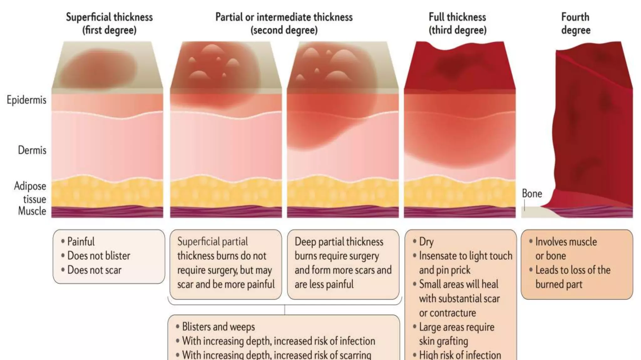 post burn contracture-2.pptx