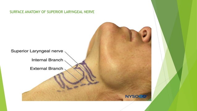 post burn contracture-2.pptx