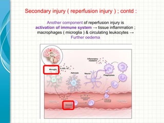 Post cardiac arrest brain injury Jan 2023.pptx
