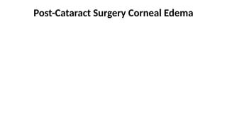 Post cataract surgery corneal oedema.pptx