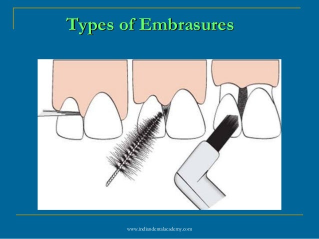 Post cementation/ orthodontic continuing education