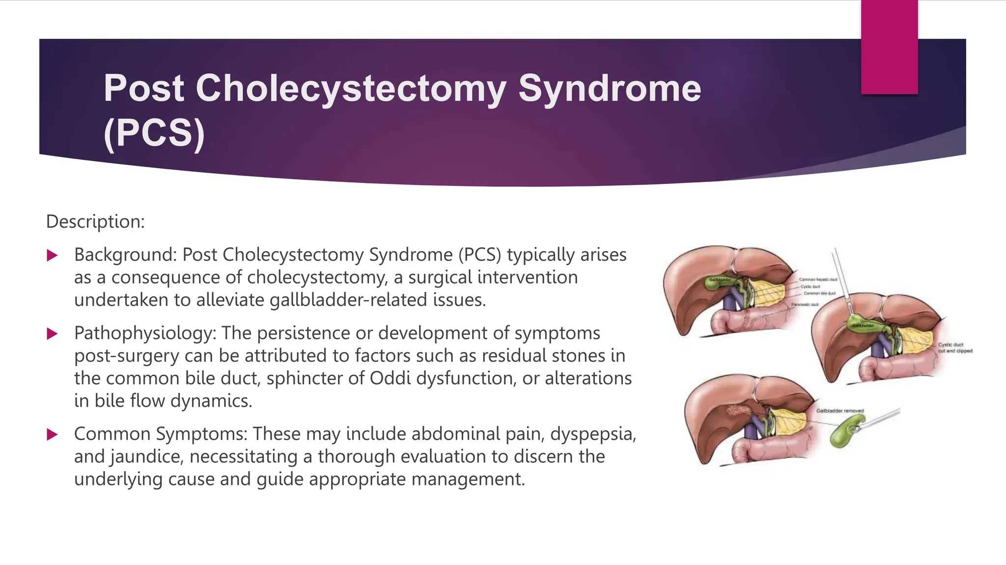 Post Cholecystectomy Syndrome and Chronic Cholelithiasis.pptx