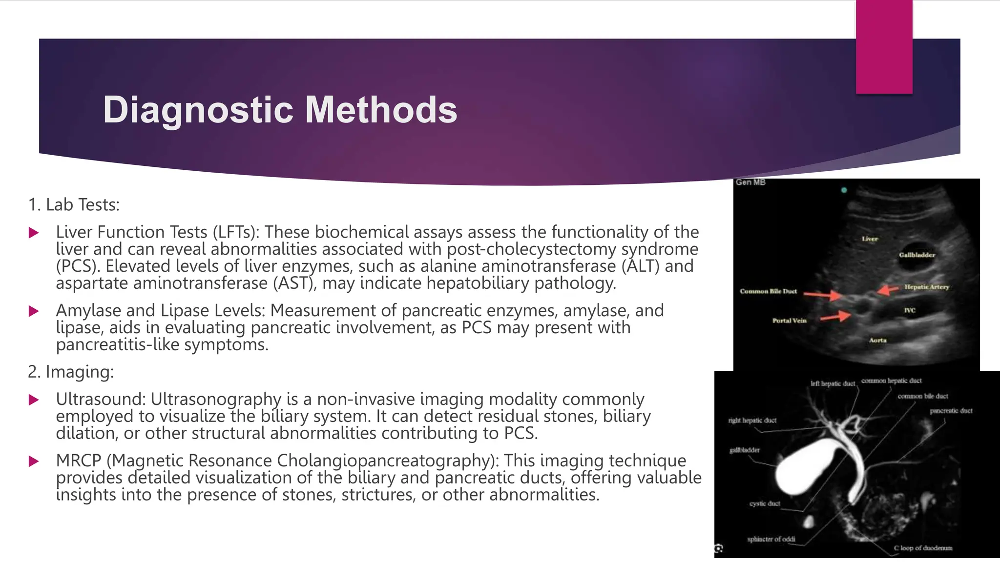 Post Cholecystectomy Syndrome and Chronic Cholelithiasis.pptx