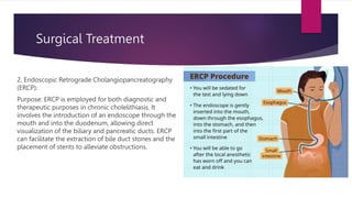 Post Cholecystectomy Syndrome and Chronic Cholelithiasis.pptx