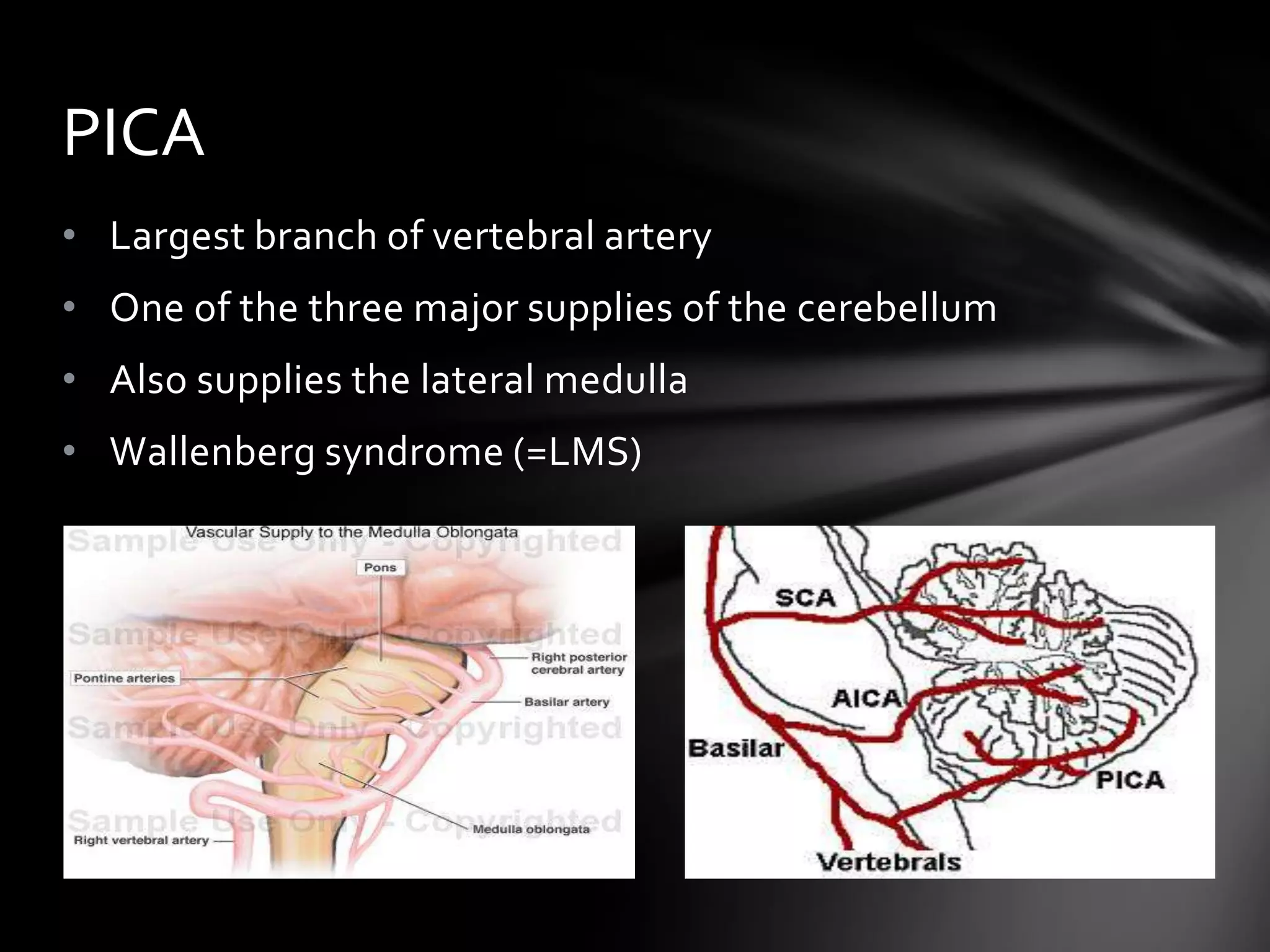 Posterior circulation - Applied Anatomy | PPTX