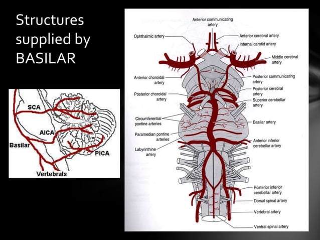 Posterior circulation - Applied Anatomy | PPTX | Death, Injury, or ...