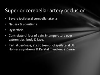 Superior Cerebellar Artery Syndrome