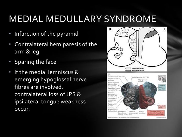 Posterior circulation - Applied Anatomy