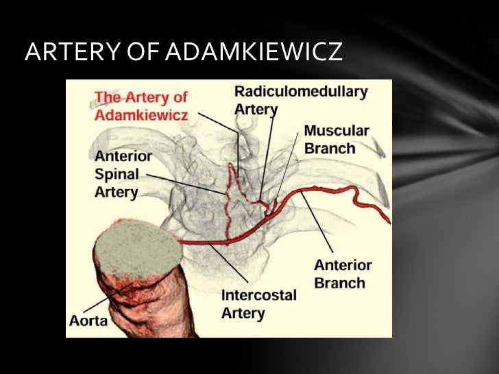 Artery Of Adamkiewicz Angiogram