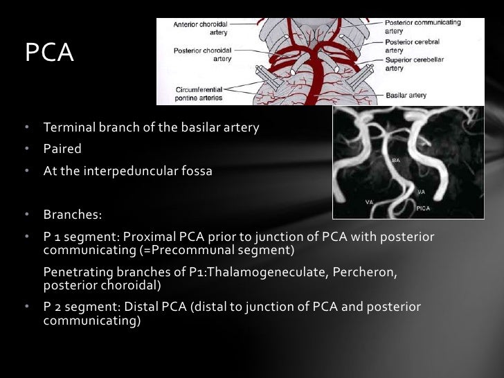 Posterior circulation - Applied Anatomy