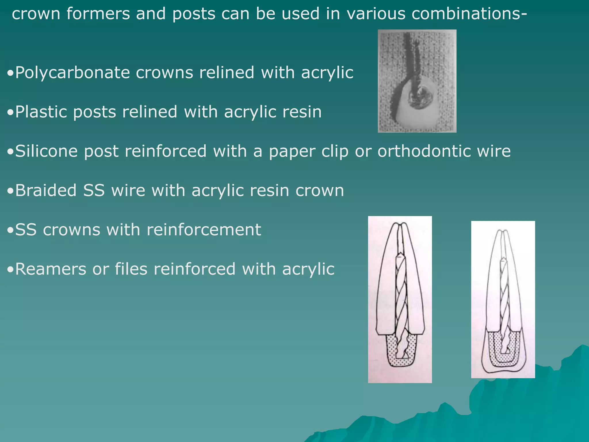 POST & CORE.ppt