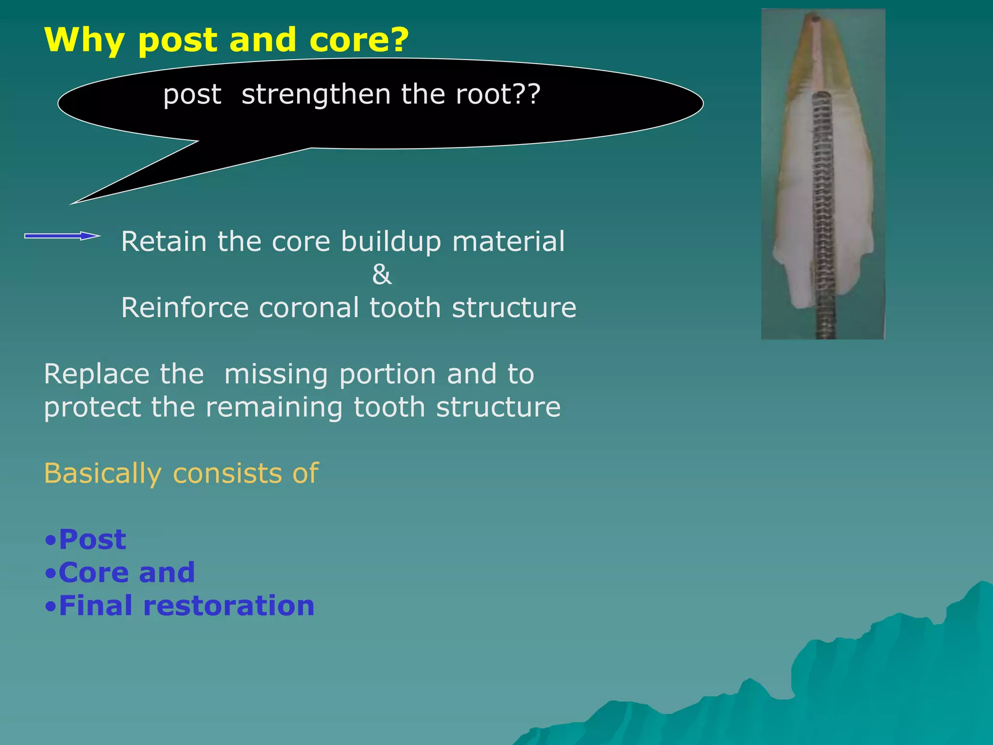 POST & CORE.ppt