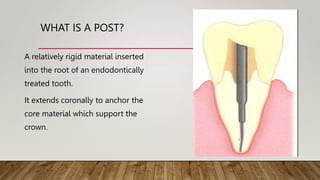 POST&CORE.ppt | Dental Health | Diseases and Conditions