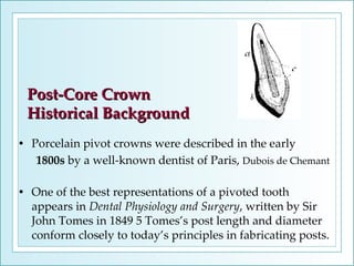 Post core crown | PPT