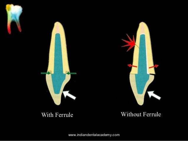 Post & core in dentistry / orthodontic continuing education