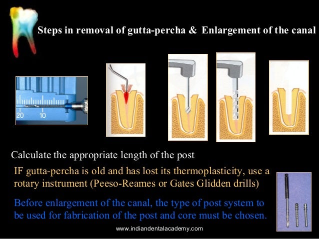 Post And Core In Dentistry Orthodontic Continuing Education