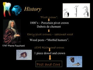 Post & core | PPT