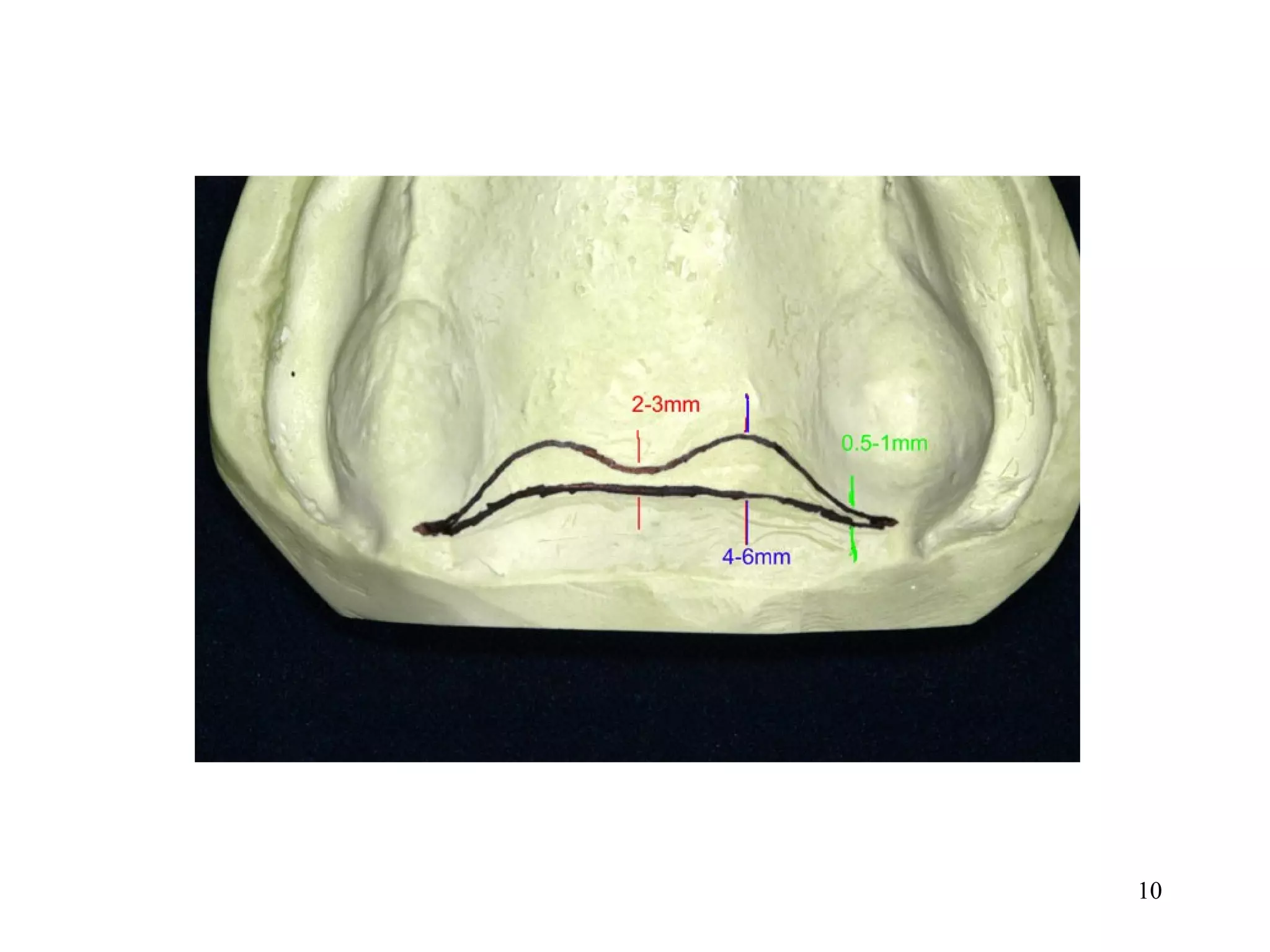 Post damming المحاضرة 8+9 | PPT