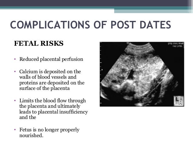 Post dates and induction