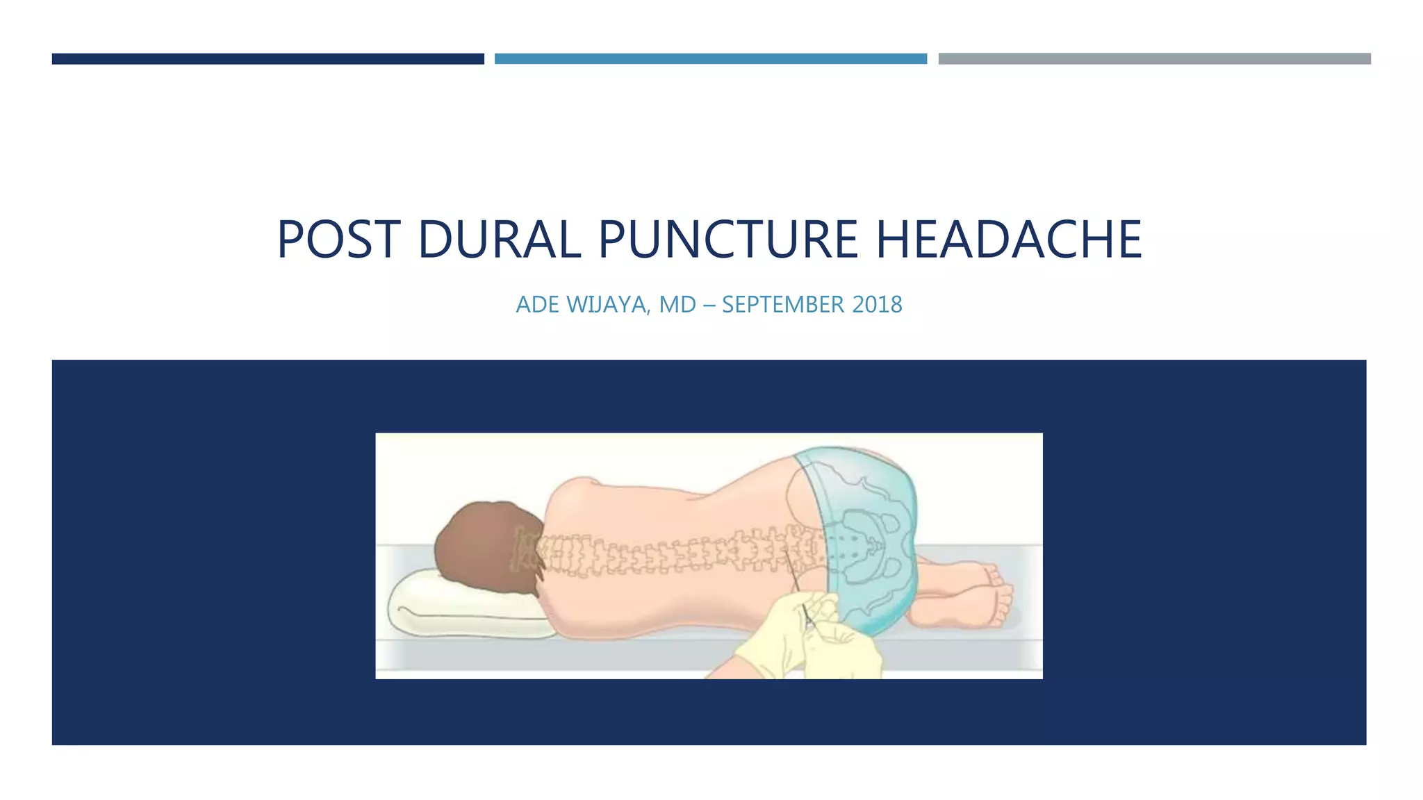 Post Dural Puncture Headache | PPTX