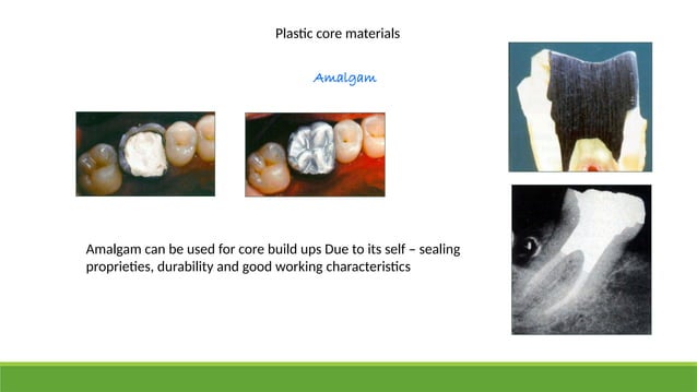 post endontic restoration and post and core .pptx