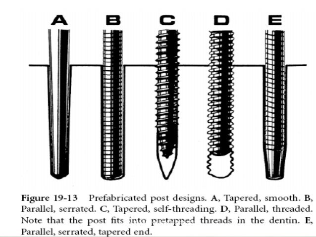 Post endodontic restoration/ orthodontic continuing education