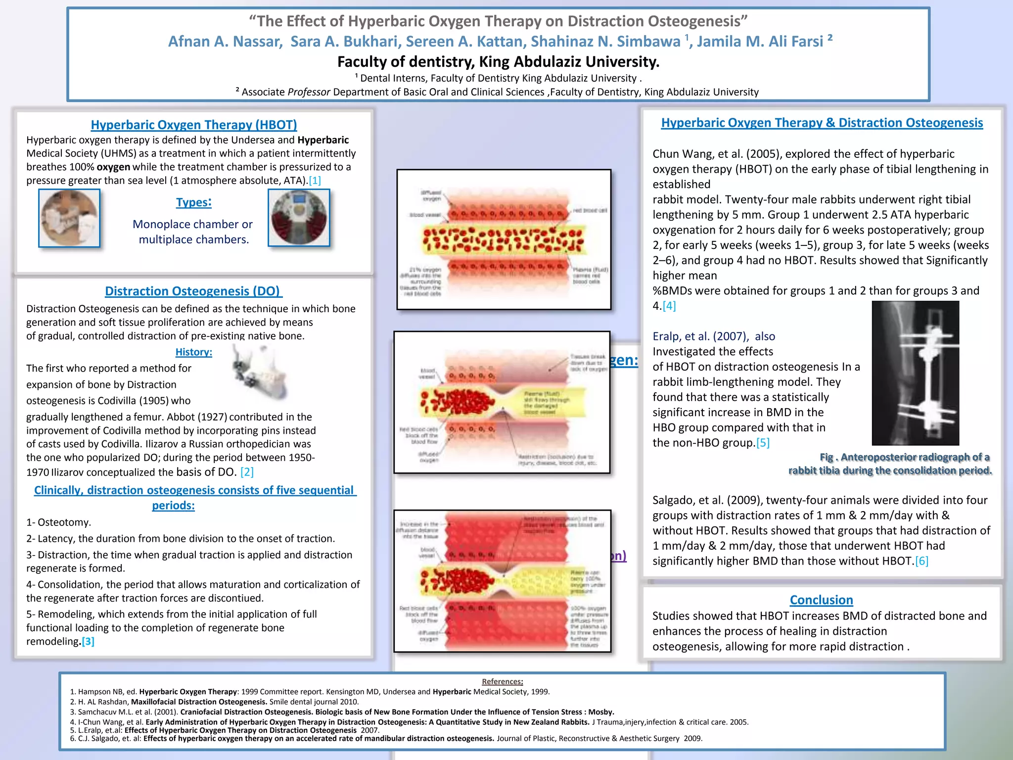 Poster about Hyperbaric Oxygen | PPTX