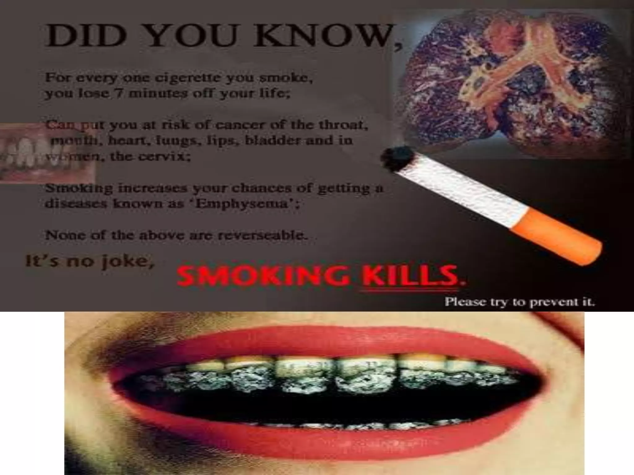 THE DEFINITION OF POSTER AND THE EXAMPLES | PPTX