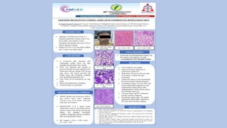 POSTER_015540.pptx LCH in adult diagnosed by fnac | PPT
