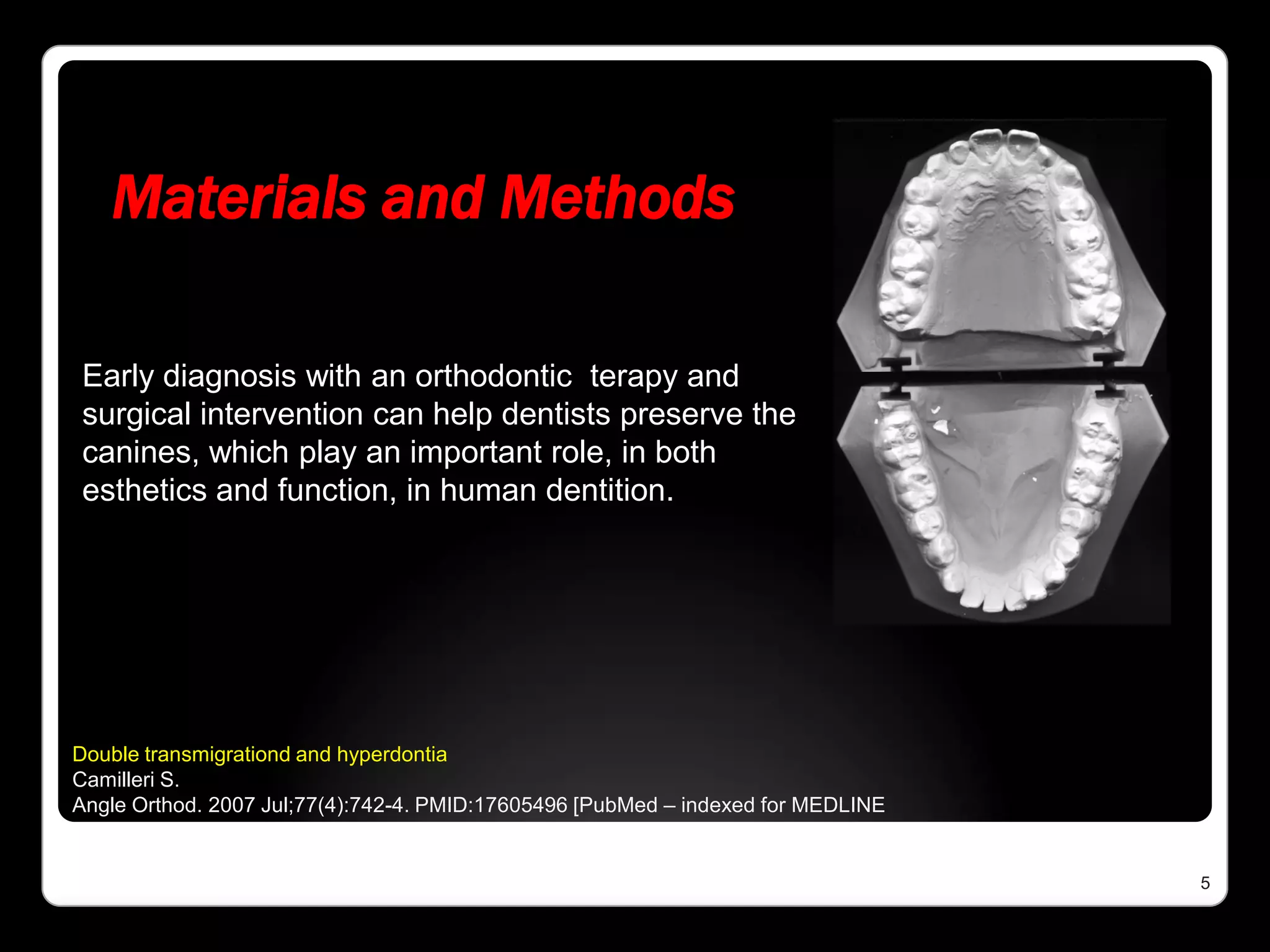 Transmigration of permanent mandibular canines | PDF